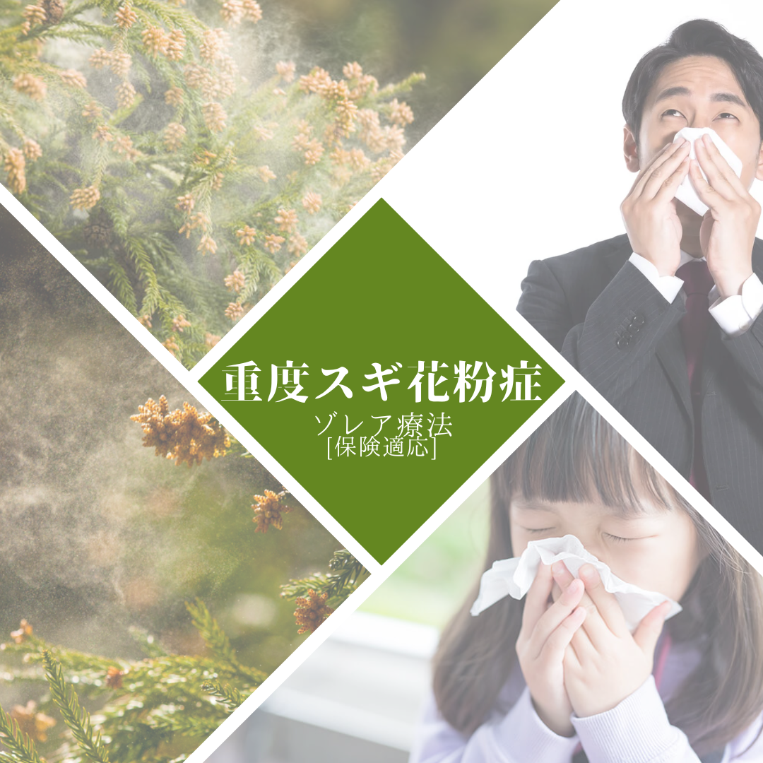 ゾレア治療について - 柏みんなクリニック イオン柏院2F 小児科 耳鼻科 アレルギー科 内科